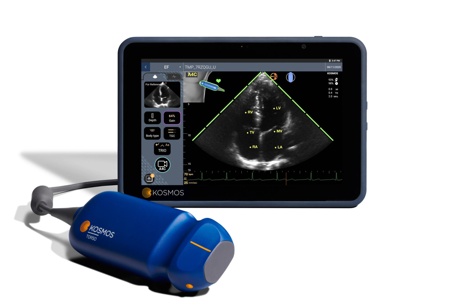 ECHONOUS Kosmos DE – ultrasoundmarkt.ch.de