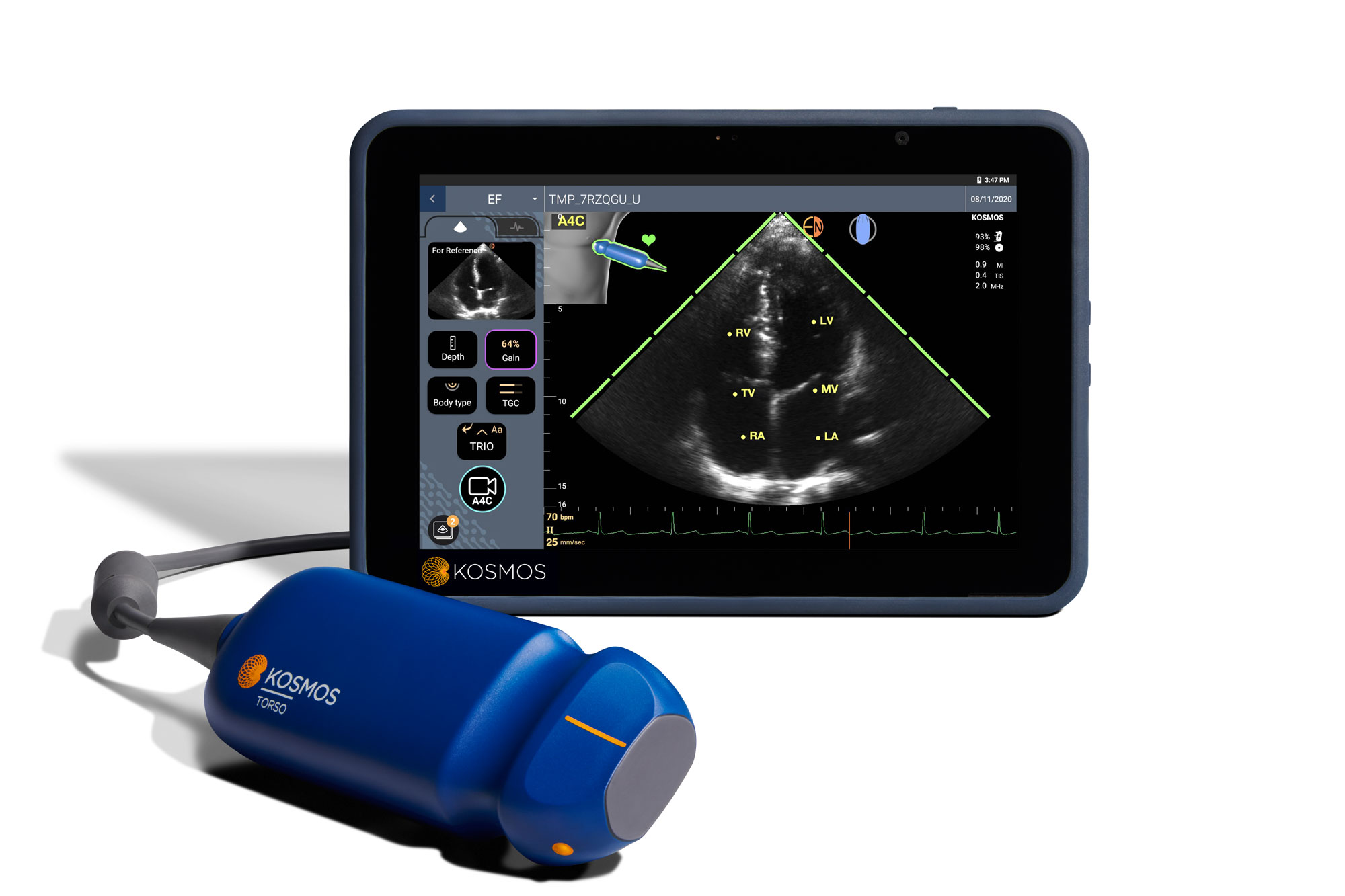 ECHONOUS Kosmos DE – ultrasoundmarkt.ch.de
